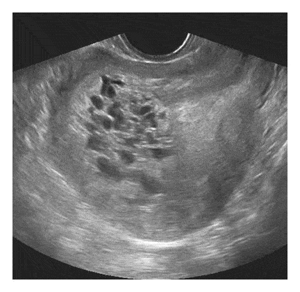 hamil anggur - Hamil.co.id